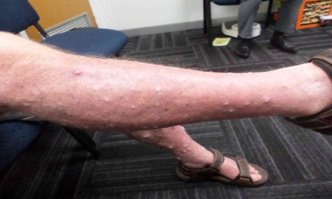 Guess the Diagnosis – Answer Revealed - Infinity Pathology